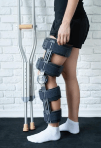 59) Anterior Cruciate Ligament Injury Cross Bracing Protocol